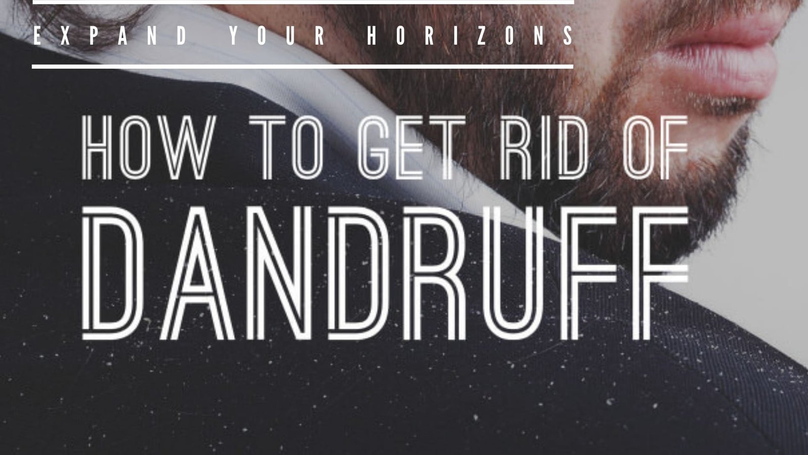 Dandruff Causes | Identifying the Root of the Problem